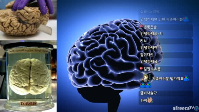 생 긴급생방 인간의 뇌는 90가 가짜다ㅣ뇌가 없어도 사는 사람들ㅣ일요미스테리 Soop Vod